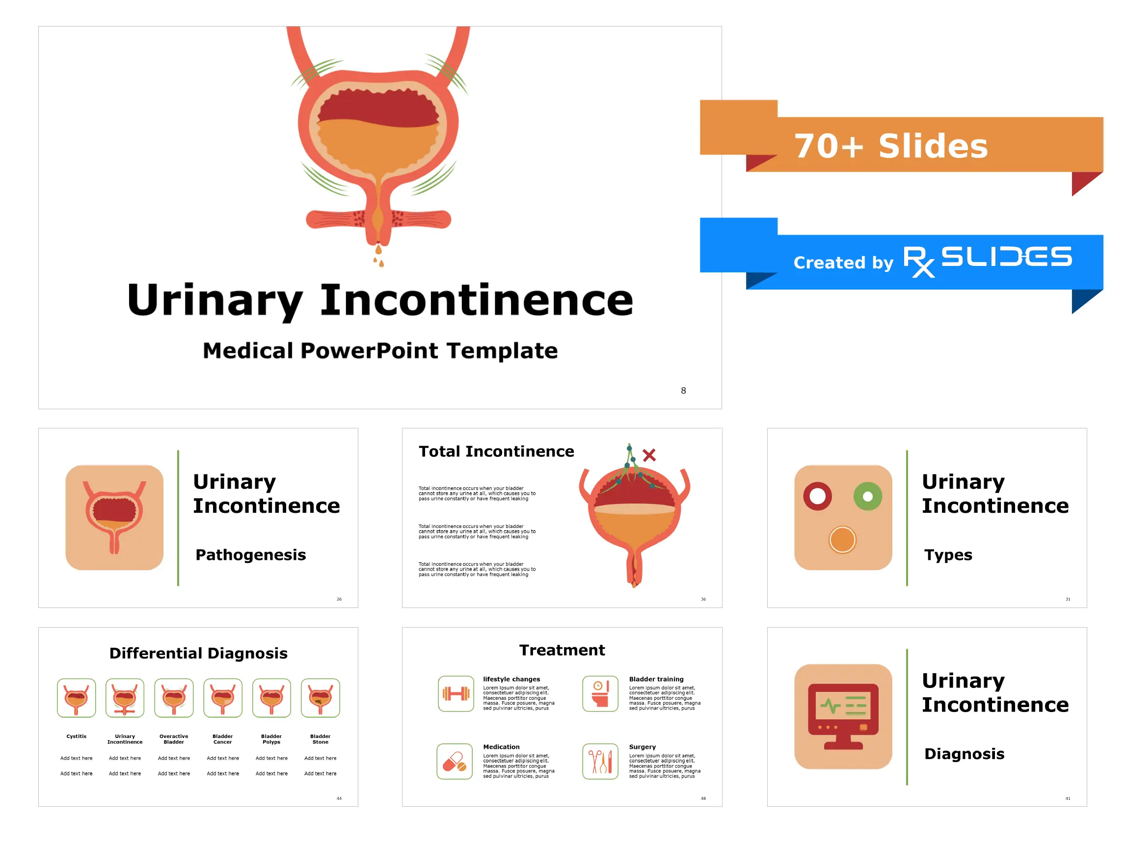 Download Urinary Incontinence PowerPoint Template|RxSlides